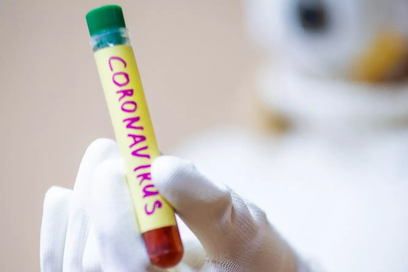 क्या पित्ती कोरोनावायरस का लक्षण हो सकती है?