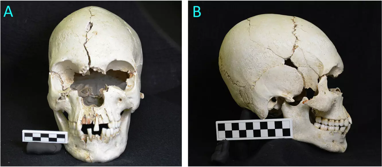 Archaeologists nrhiav pom cov kob uas tsis muaj neeg nyob uas tuaj yeem ua tus mob ruas 200 xyoo dhau los 391411_2