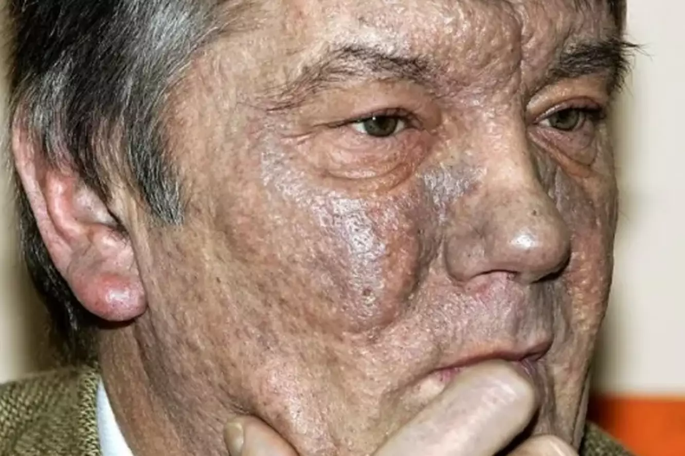 Majele ti o jẹ oloro Viktor Yushchenko: kini a mọ nipa dioxin loni?