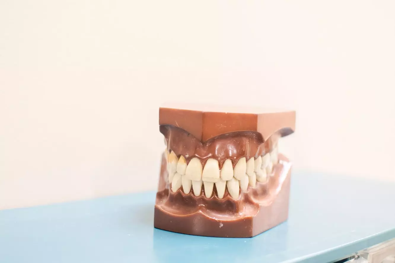 Dentures adabwerera ku Brit yemwe adawataya ku Spain zaka 11 zapitazo