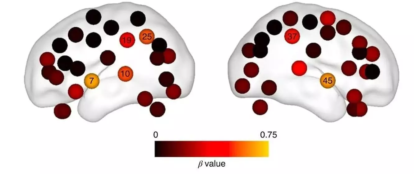 Vastsündinu aju neuroimaging