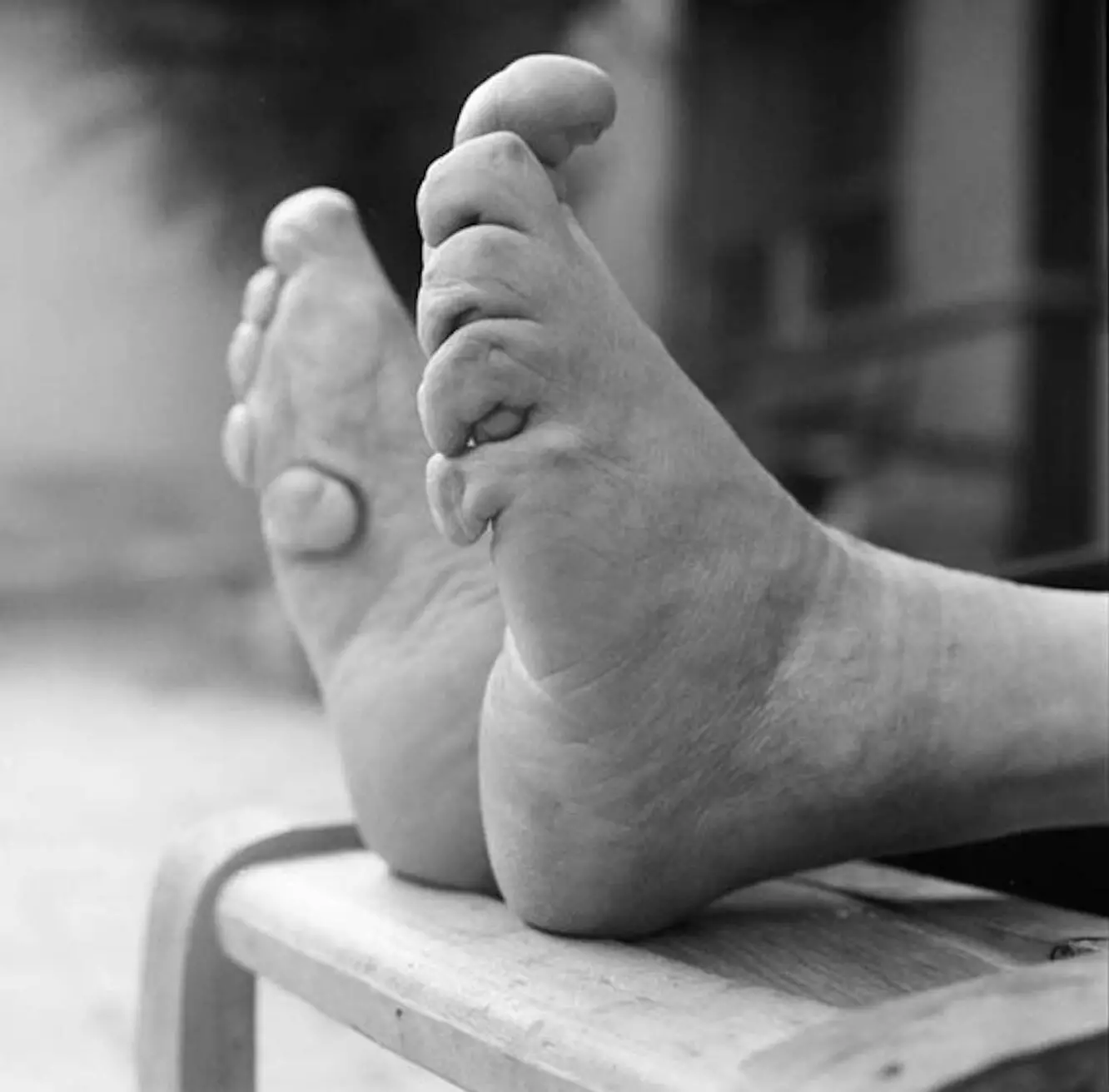 10 fakta ngeunaan praktek Cina footbinding 54777_6